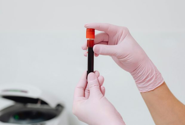 MCHC Blood Test Ranges: Normal, Low, and High - Cynthia Vincent